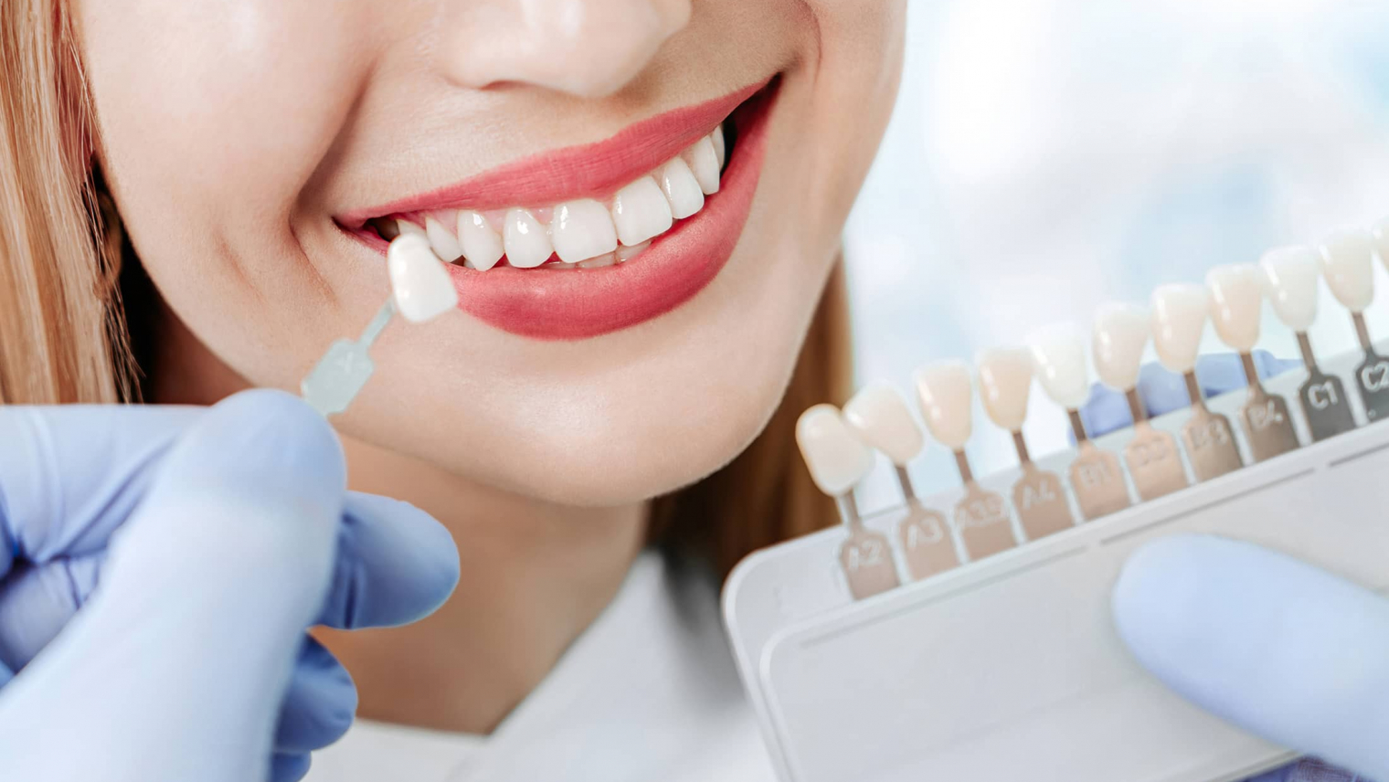 Free Shade Consultations – Luminous Dental Ceramics